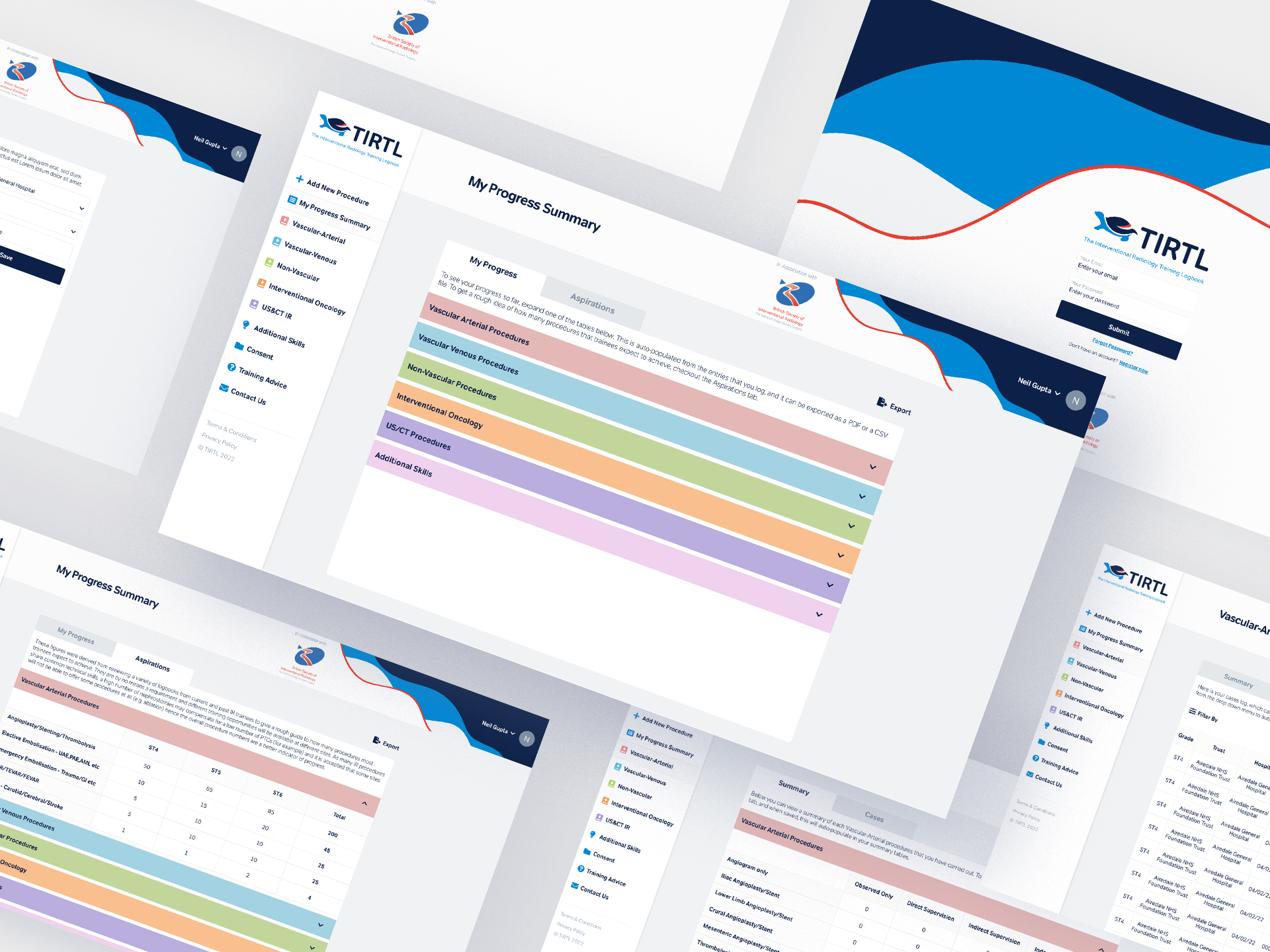 TIRTL – Interventional Radiology Solutions Ltd